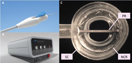 CRSToday | Precision Pulse Capsulotomy