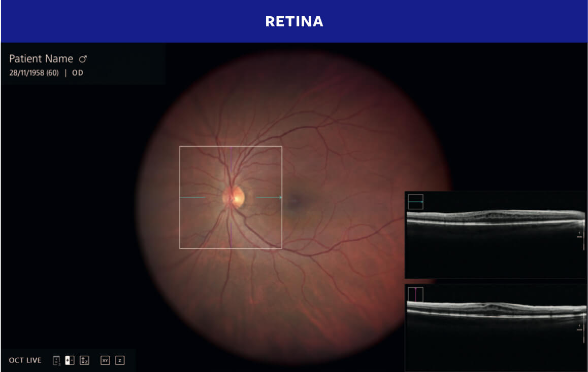 ZEISS ARTEVO 800 as the Centerpiece of a Cutting-edge OR