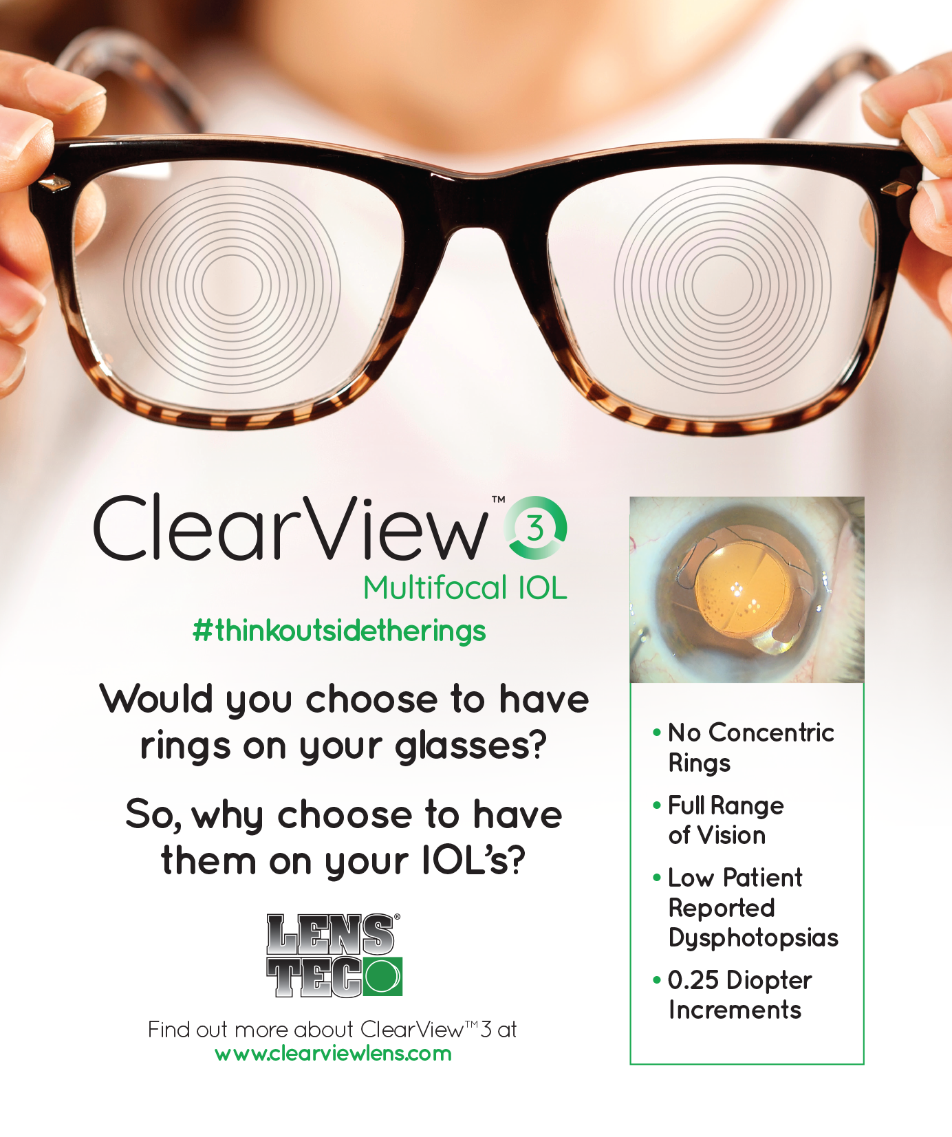 CRSToday | ICL Sizing