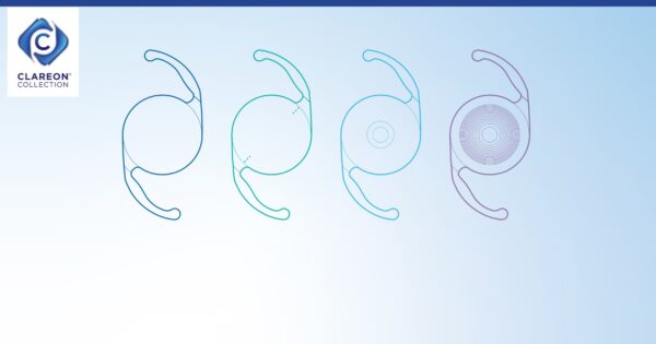 CRSToday | Clareon® Collection | Featuring J. Morgan Micheletti, MD